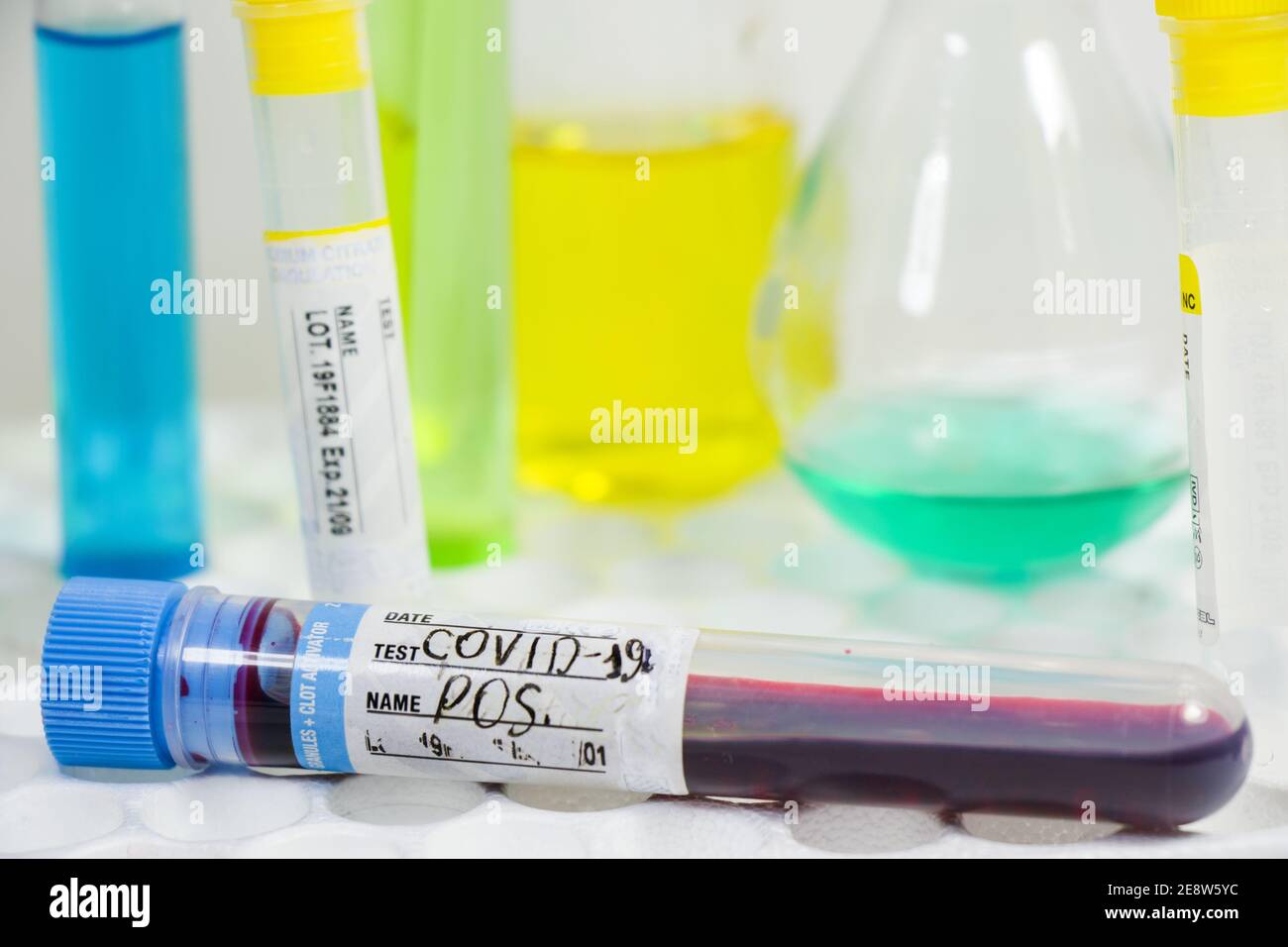Selective focus of plastic containers filled with blood for covid 19 ...