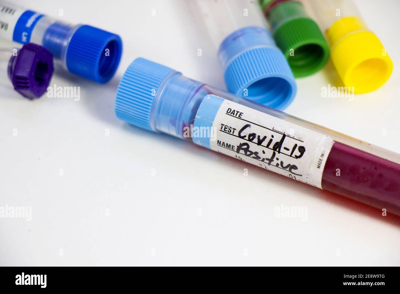 Selective focus of plastic tubes filled with blood Stock Photo - Alamy