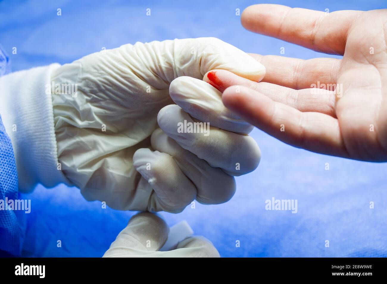 Top view of doctor's hand in gloves pricking a patient's finger with ...