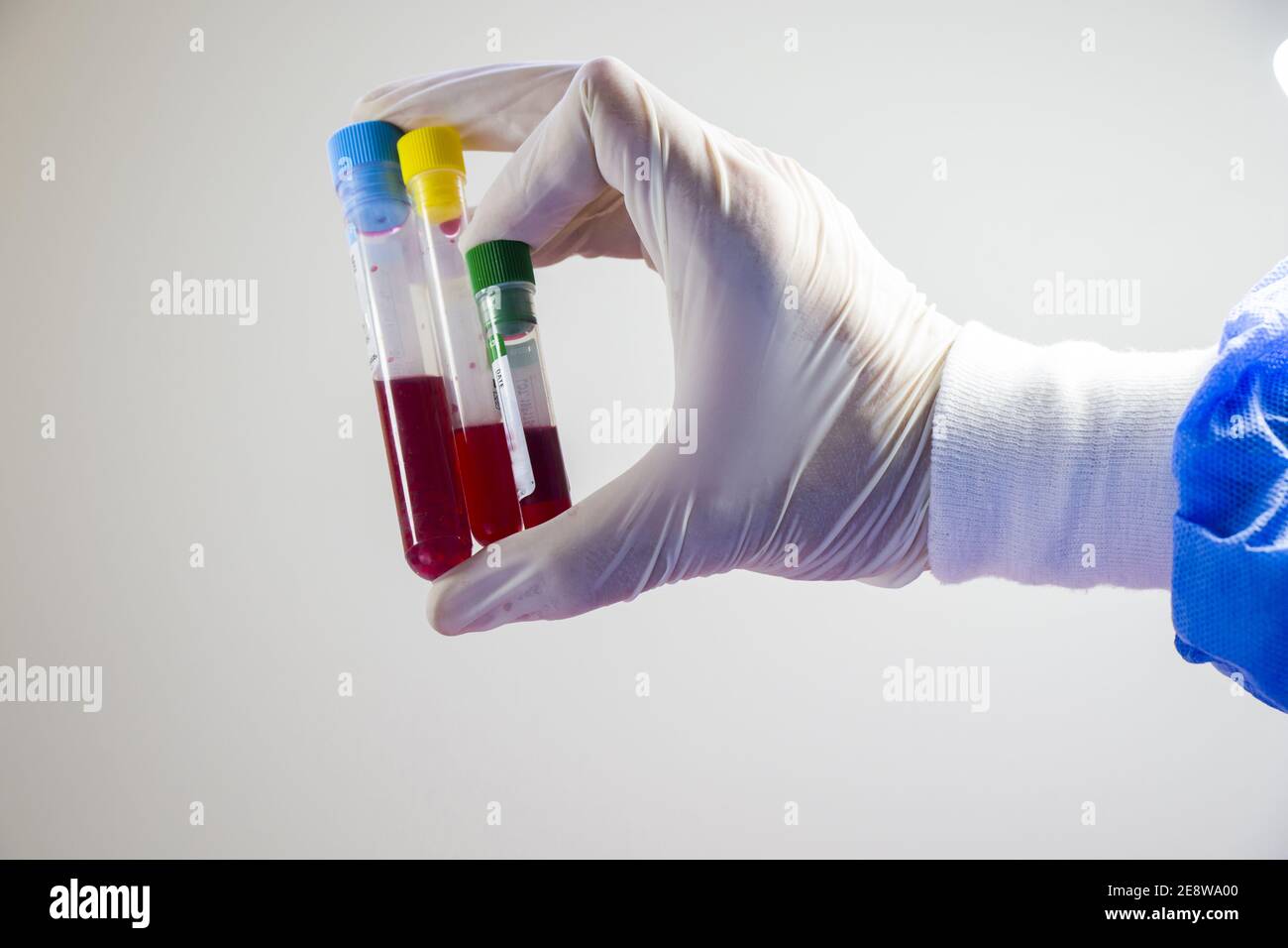 Closeup shot of hand in glove holding blood specimens on different test ...