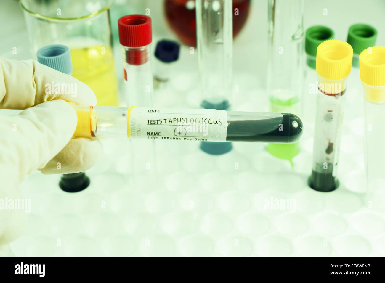 Closeup shot of a tube for a staphylococcus test in the laboratory ...