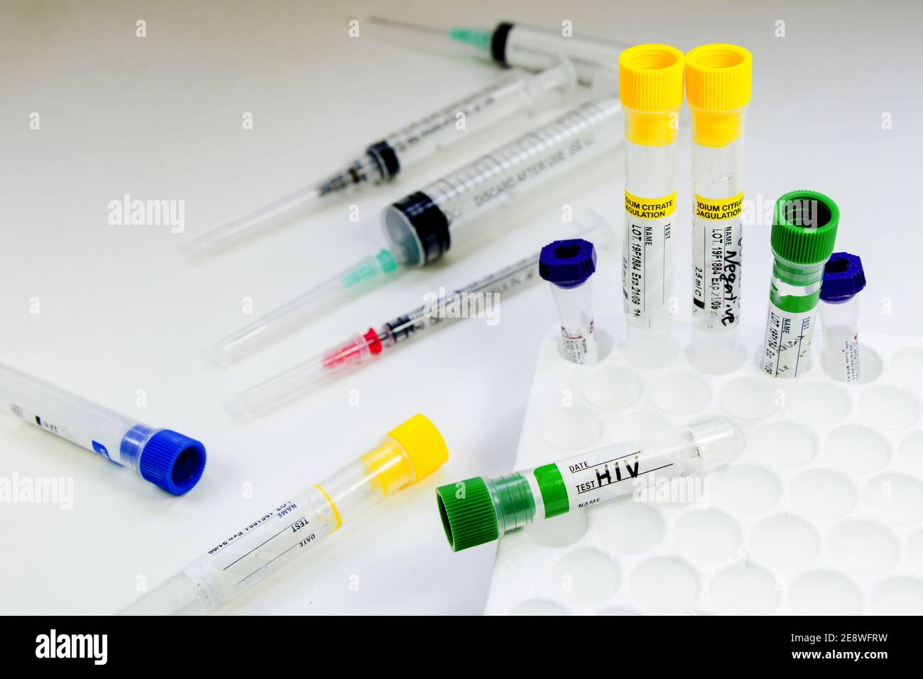 Selective focus of an HIV blood test in the laboratory Stock Photo - Alamy