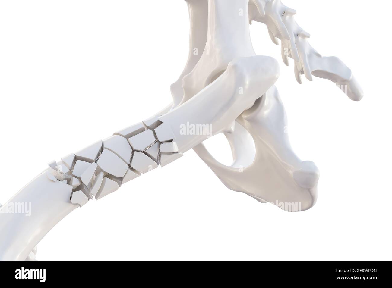 Broken dog femur bone with visible other bones. Canine skeleton 3d ...