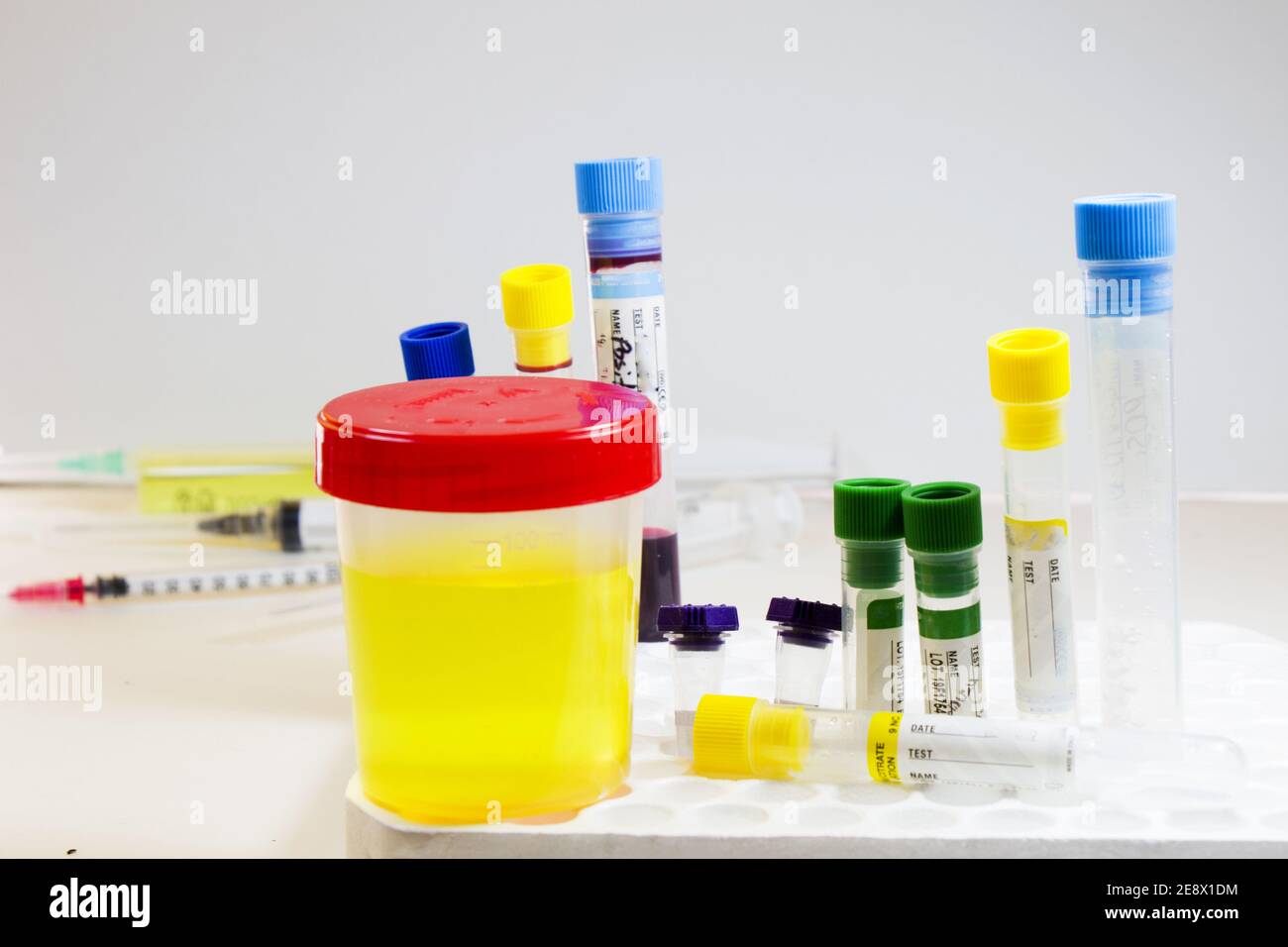 View of urine on a sterile container with different empty test tubes in ...