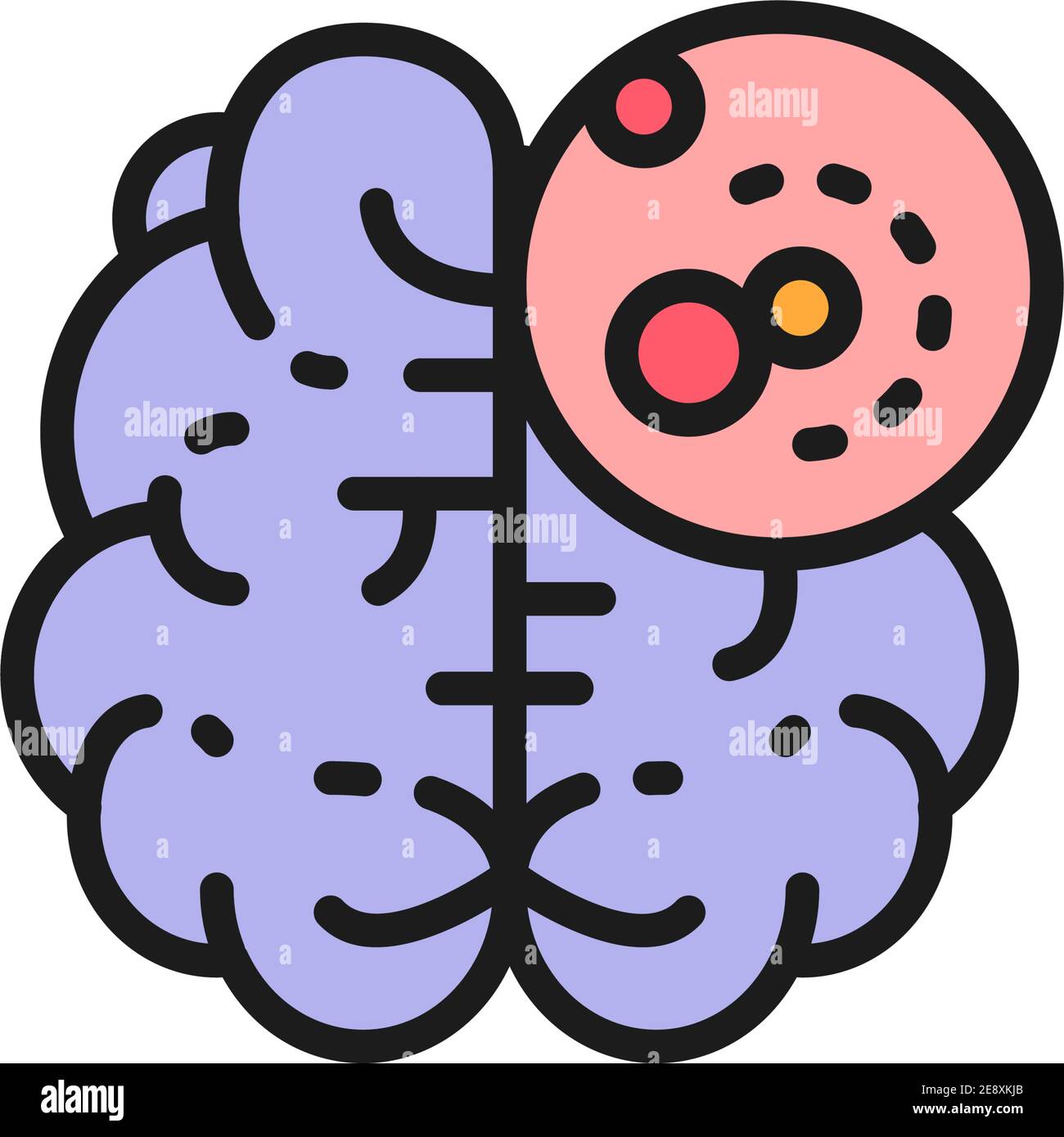 Malignant neoplasm Stock Vector Images - Alamy