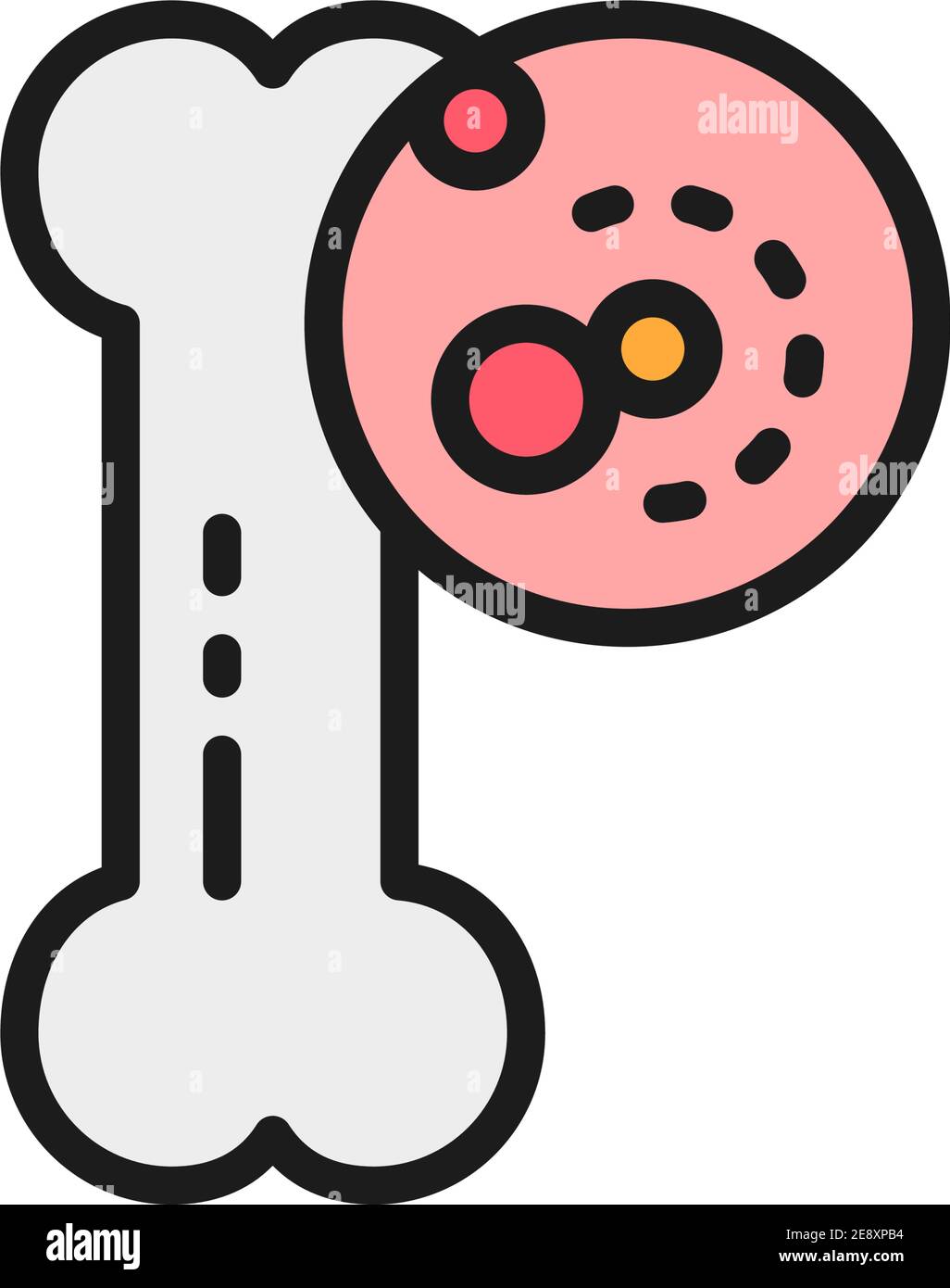 Bone Cancer High Resolution Stock Photography and Images - Alamy