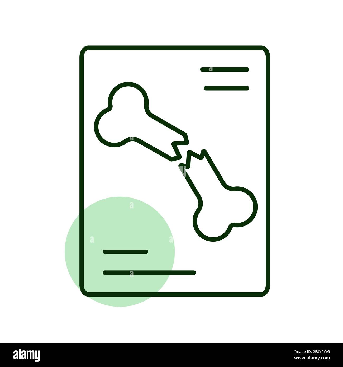 Bone fracture X-ray scan vector icon. Medicine and healthcare, medical ...