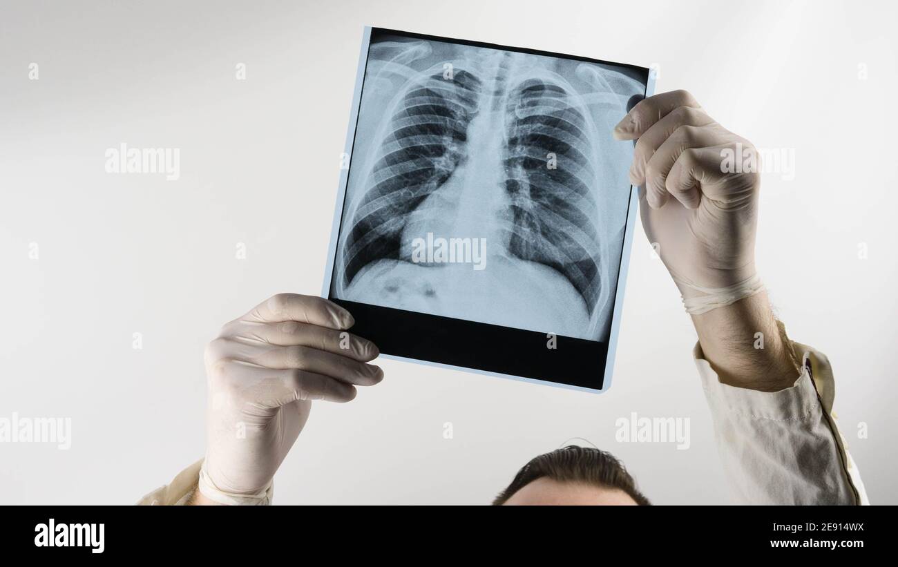 X-ray of a human lung is isolated on a white background, the doctor ...