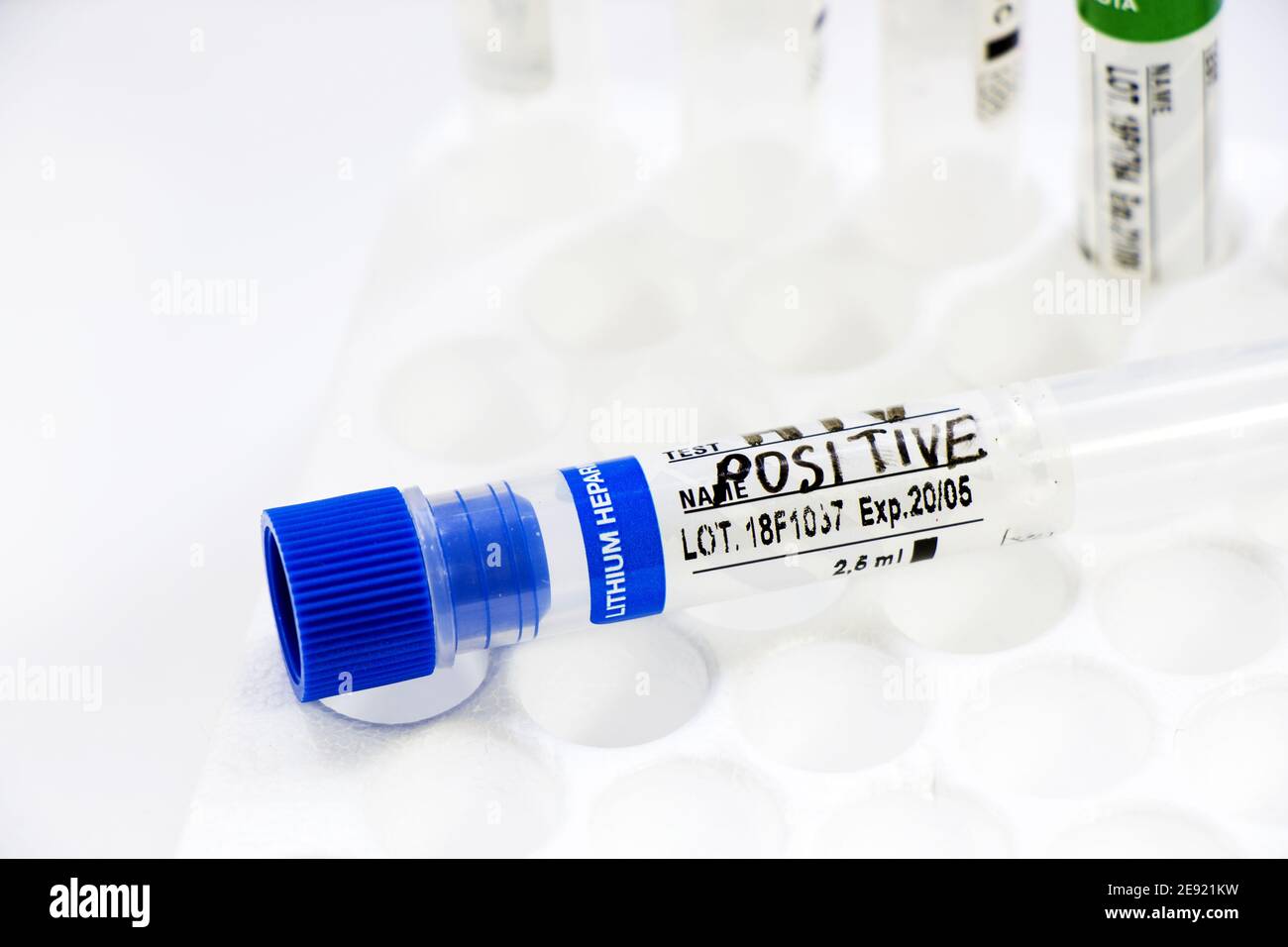 High angle shot of an empty positive HIV test tube on white background ...