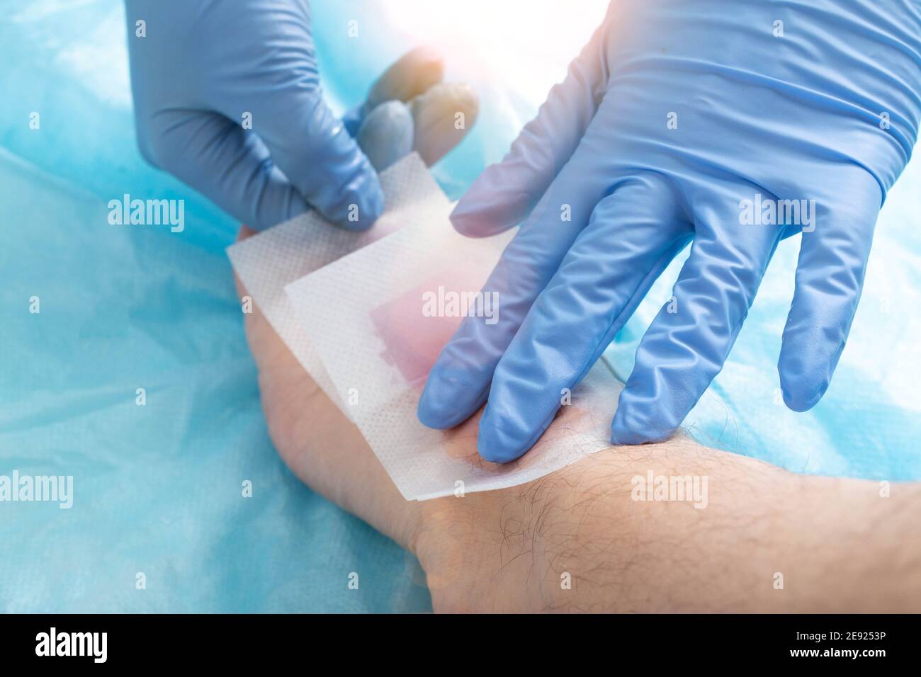 The doctor removes hair from toes with epilating wax strips. Hygiene ...