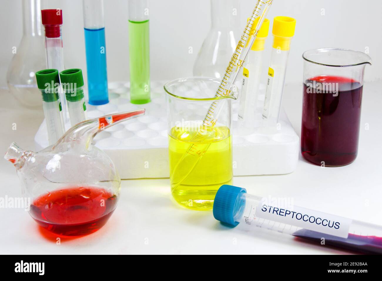 Streptococcus blood specimen on a test tube with laboratory and ...