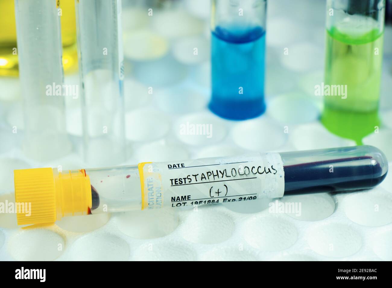 Bacteria, blood test tube samples Stock Photo - Alamy