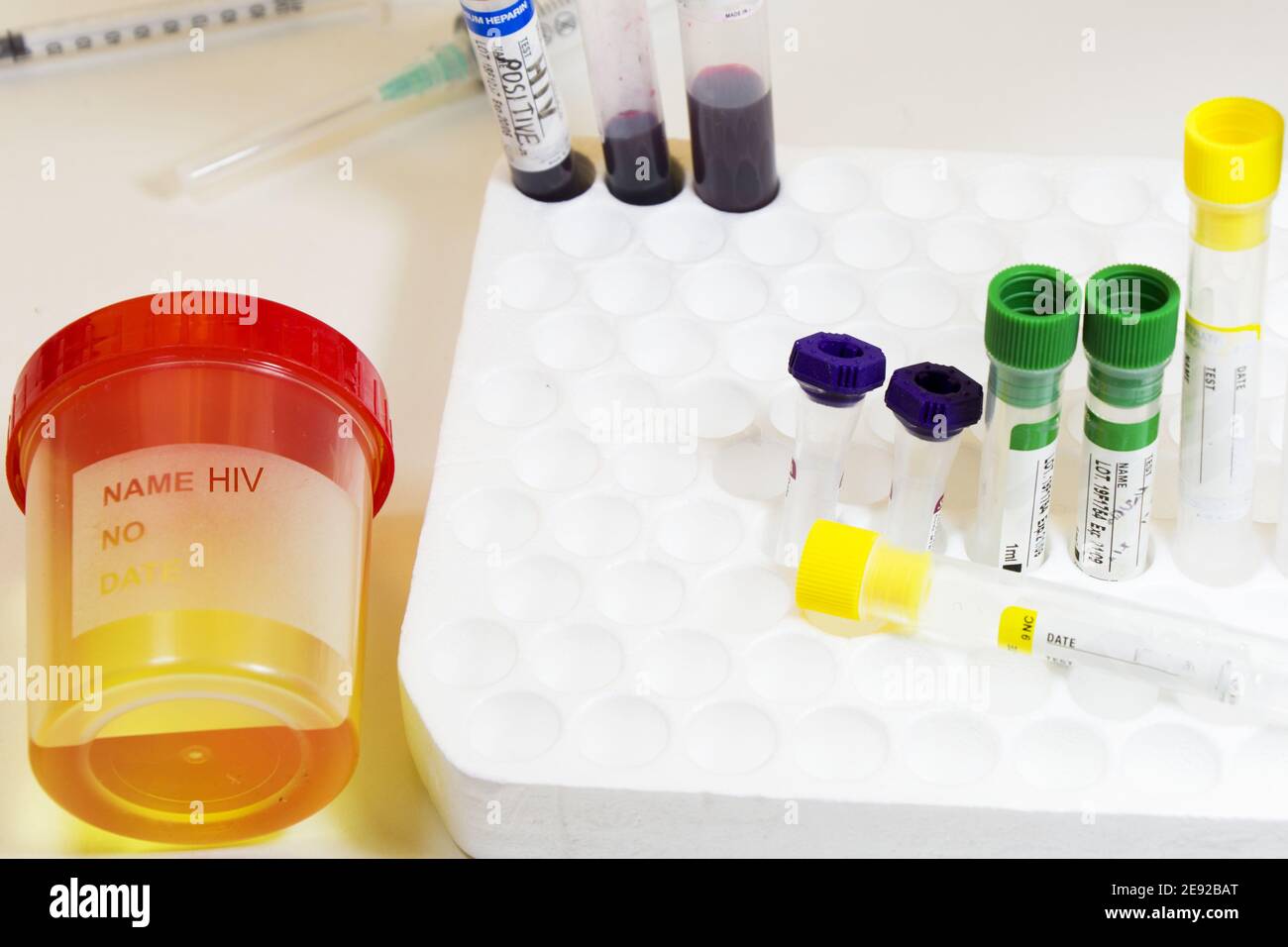 High Angle Shot Of Hiv Urine Test With Empty Test Tubes On Styrofoam Test Tube Holder Stock