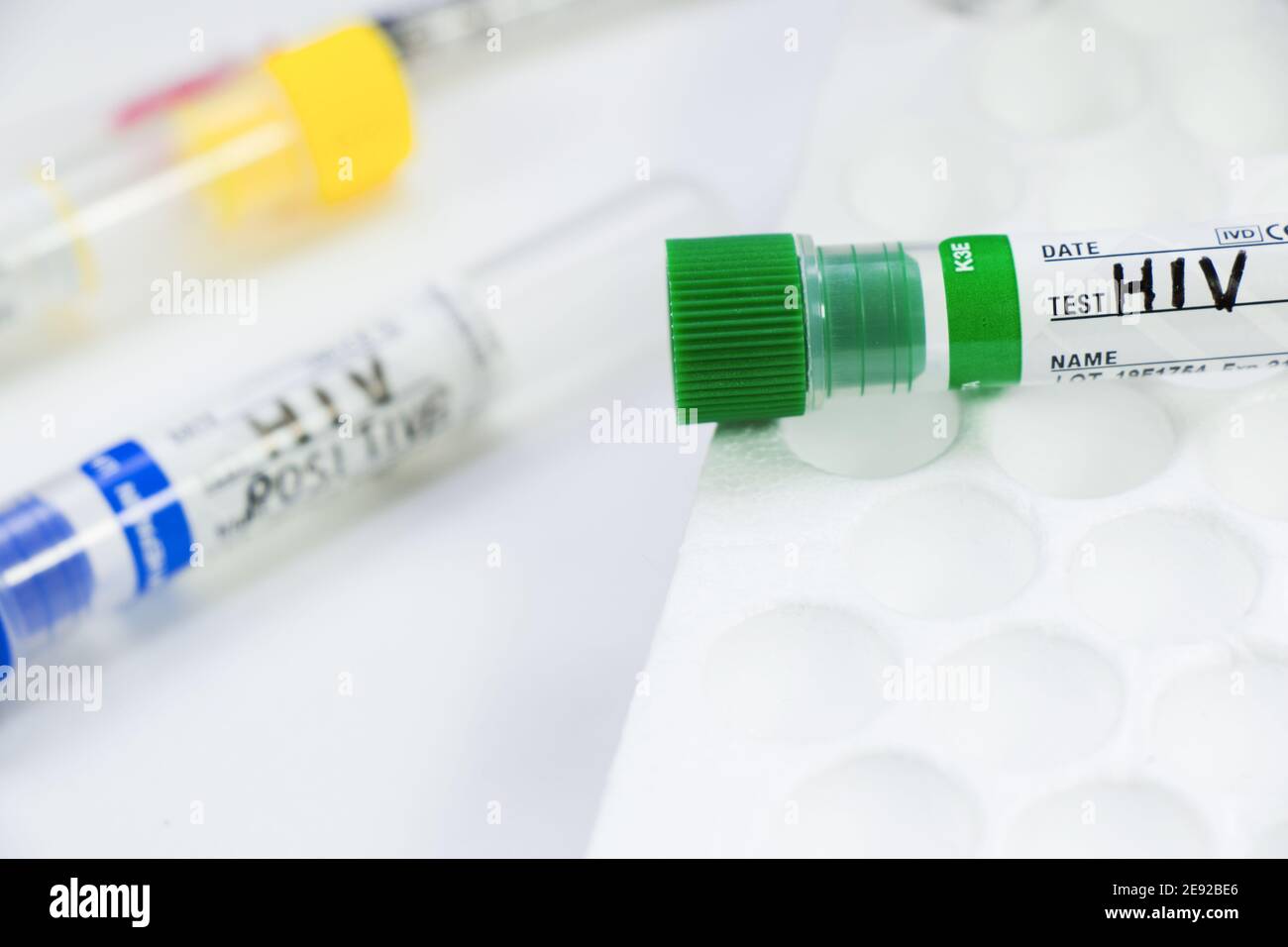 Closeup shot hiv aids hi-res stock photography and images - Alamy