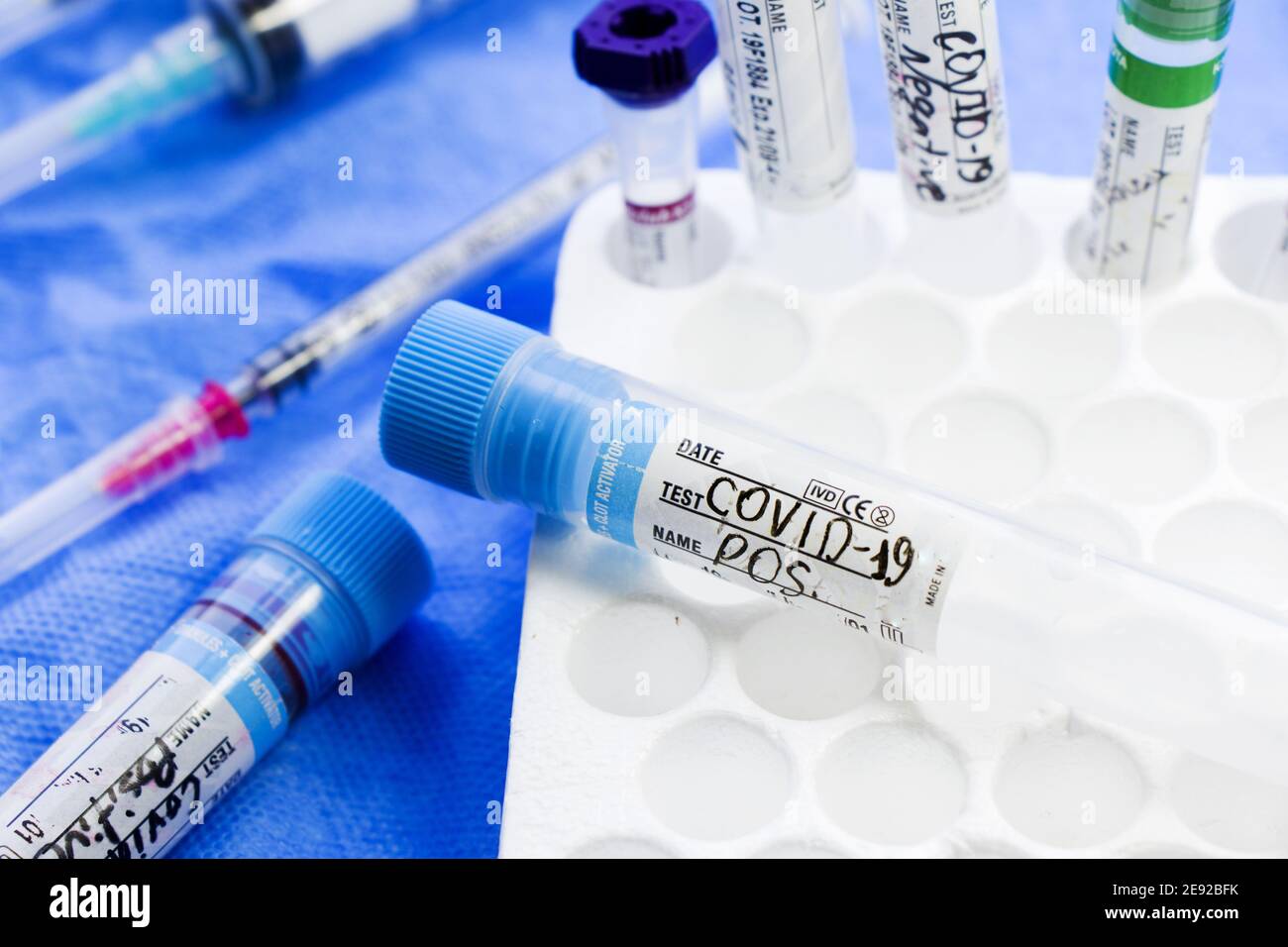 High angle of an empty positive COVID-19 test tube in the laboratory ...