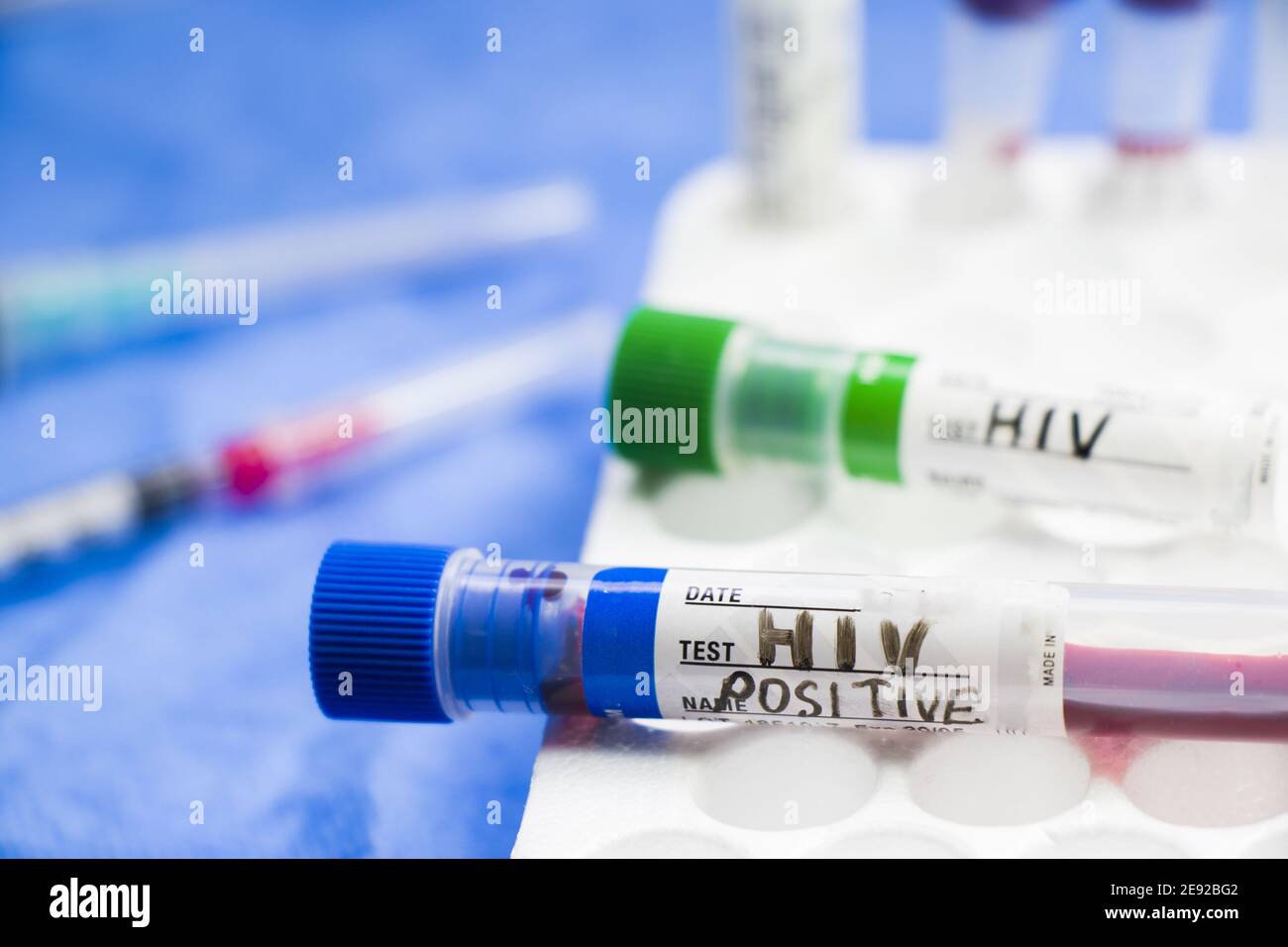 Selective focus of positive HIV blood specimen on test tube in the ...