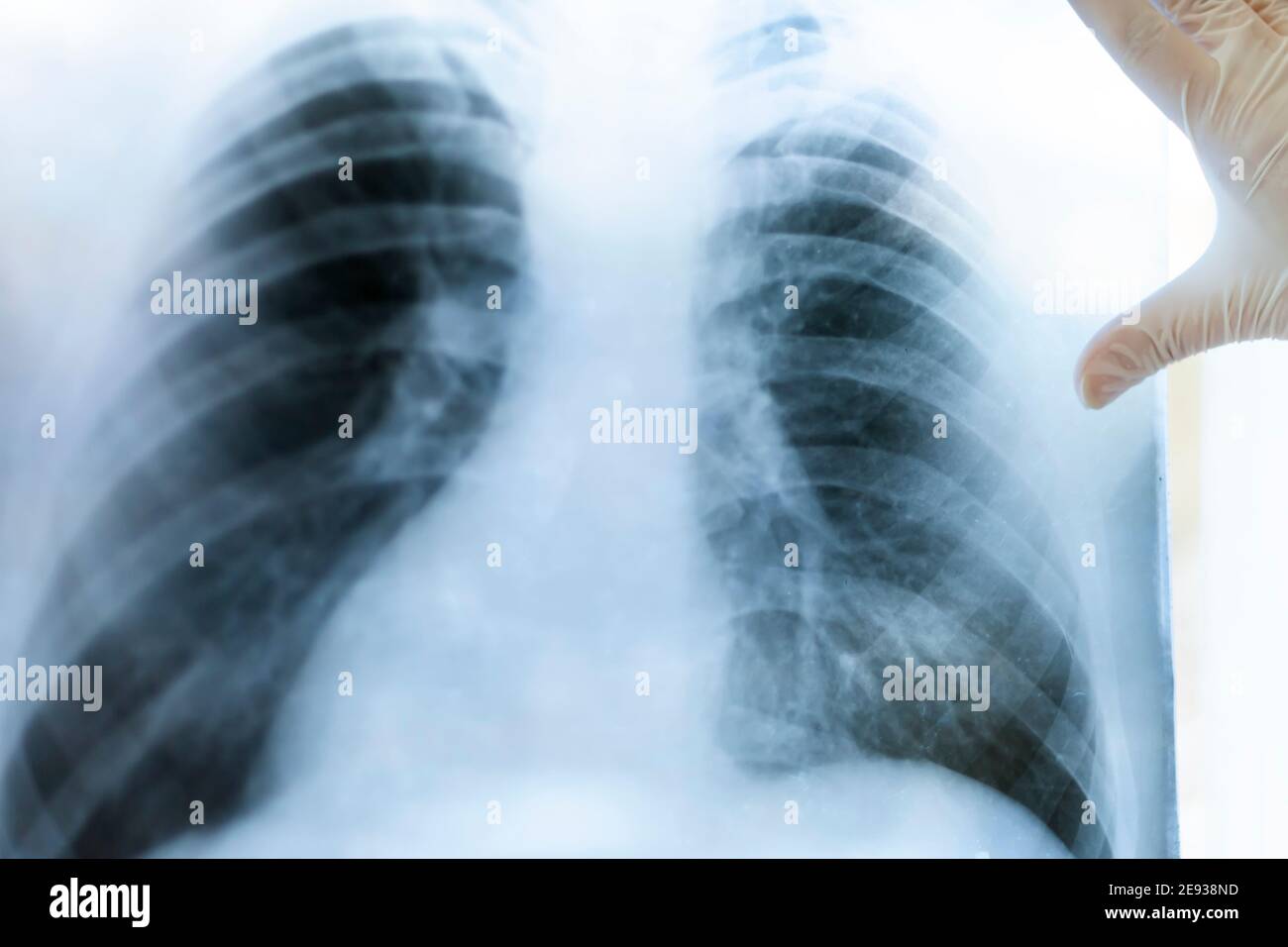 Pneumologist hi-res stock photography and images - Alamy