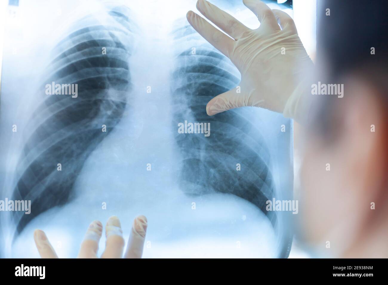 A female pneumologist holds a lung scan in her hands Stock Photo - Alamy