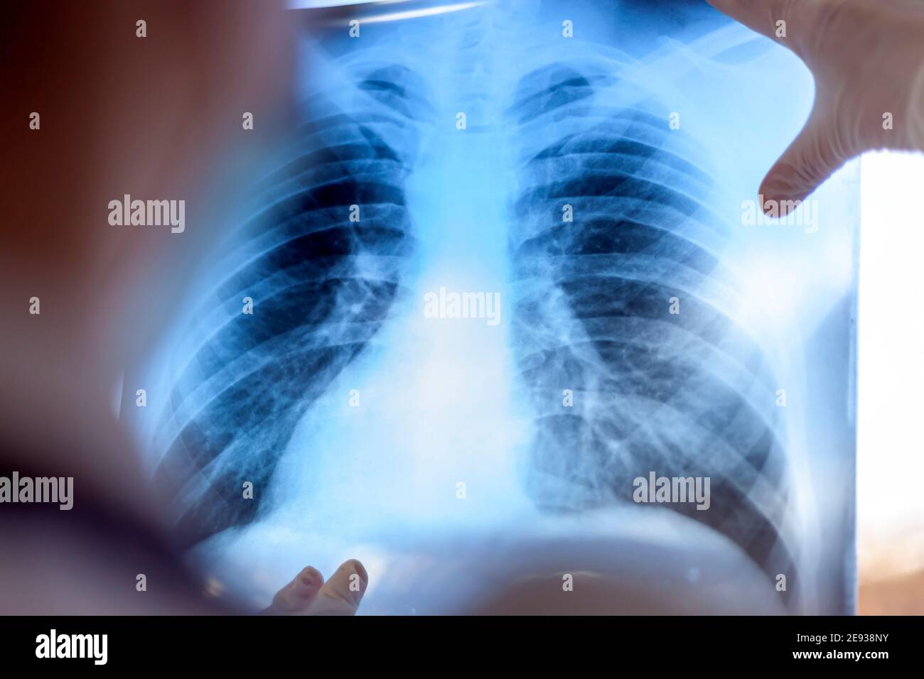 Pneumologist hi-res stock photography and images - Alamy