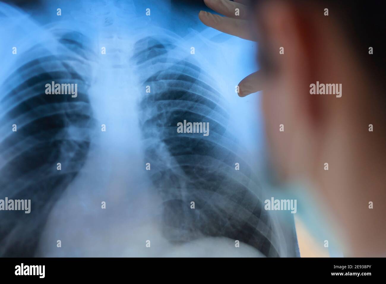Pneumologist hi-res stock photography and images - Alamy