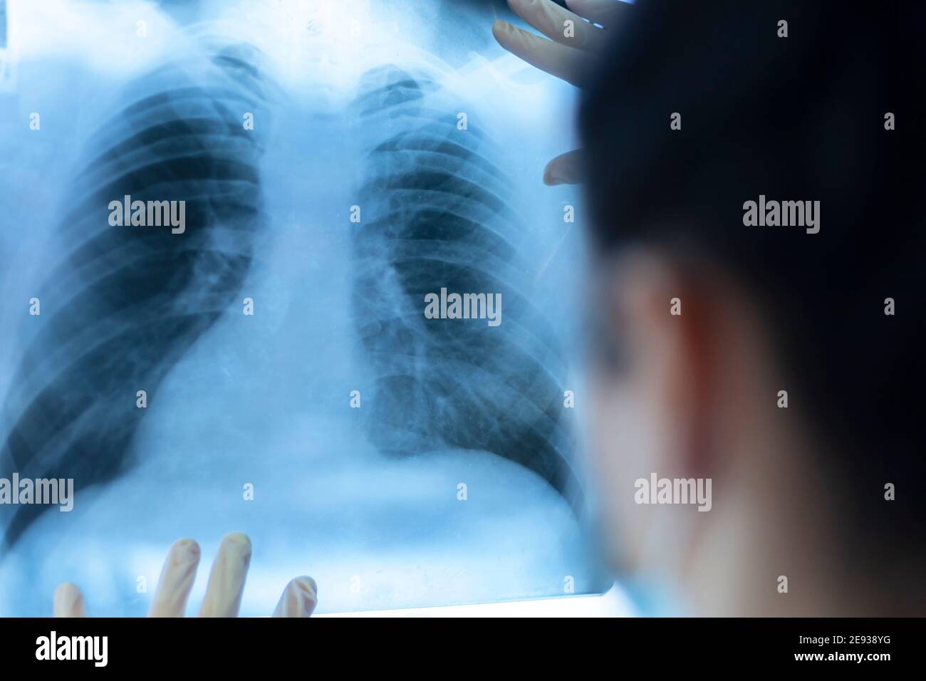 Pneumologist High Resolution Stock Photography and Images - Alamy