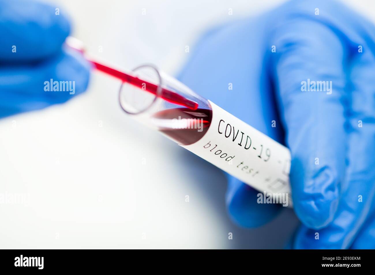 Medical lab technician placing blood sample specimen in test tube ...