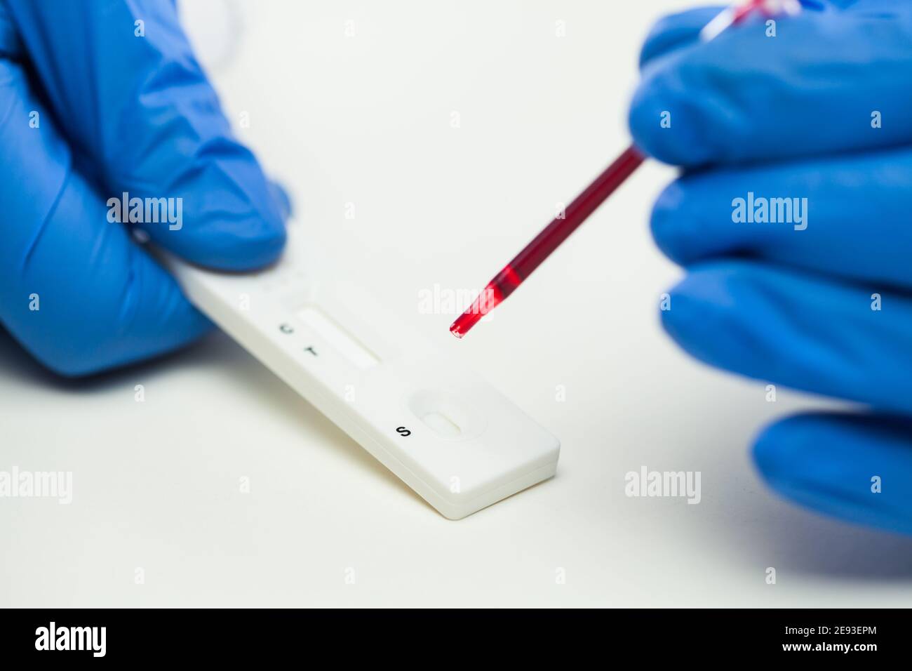 Lab scientist or doctor placing blood sample on Rapid Diagnostic Test ...