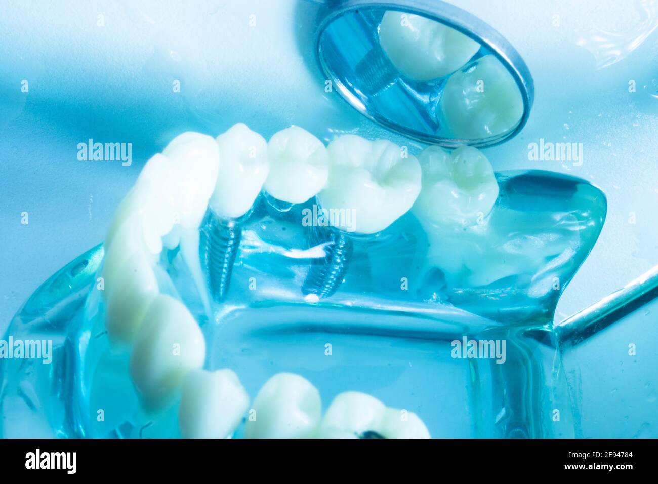 Modern metal brackets aligner straighterners used to correct alignment ...