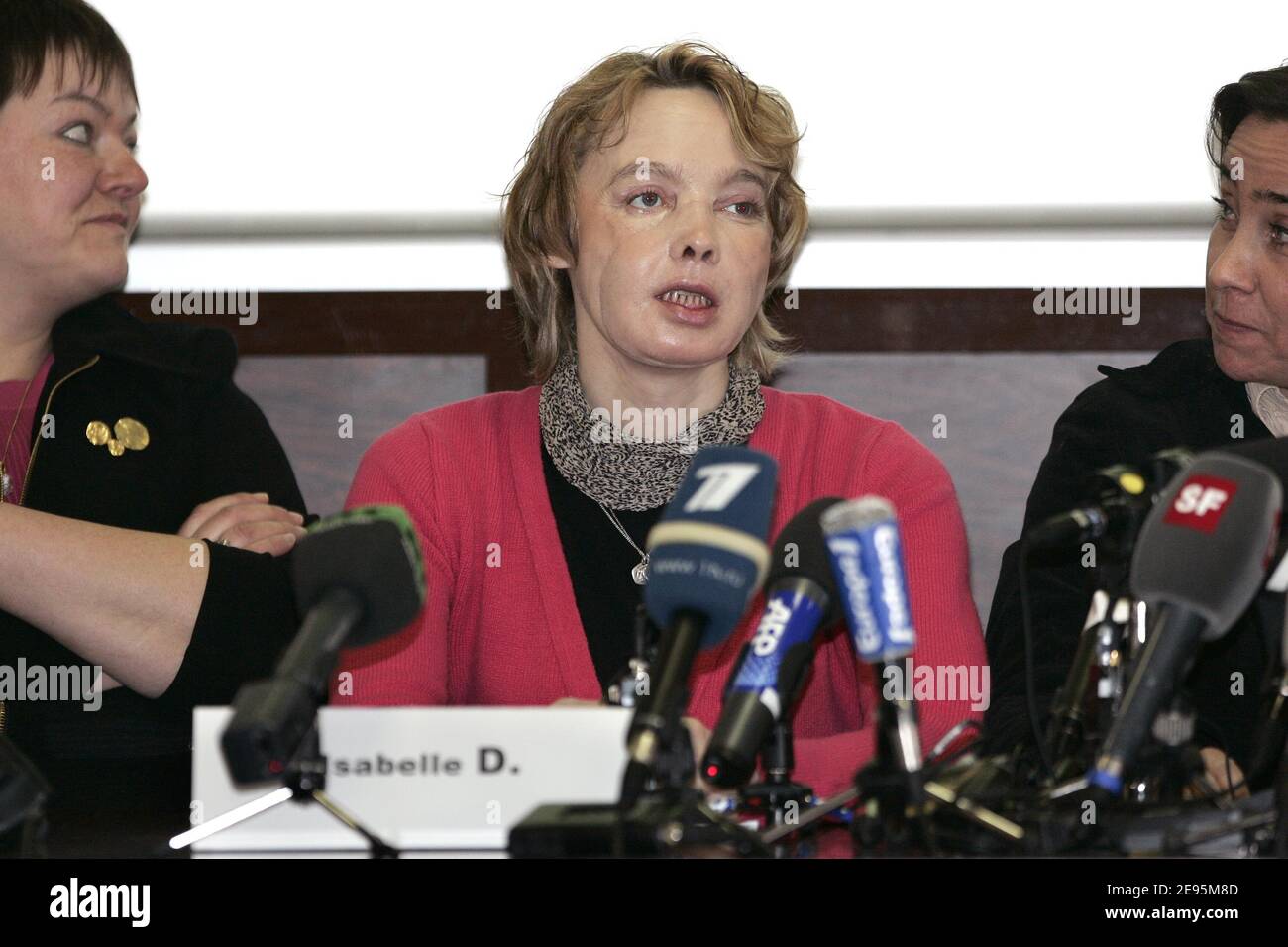 Isabelle Dinoire, the French woman who received the world's first ...