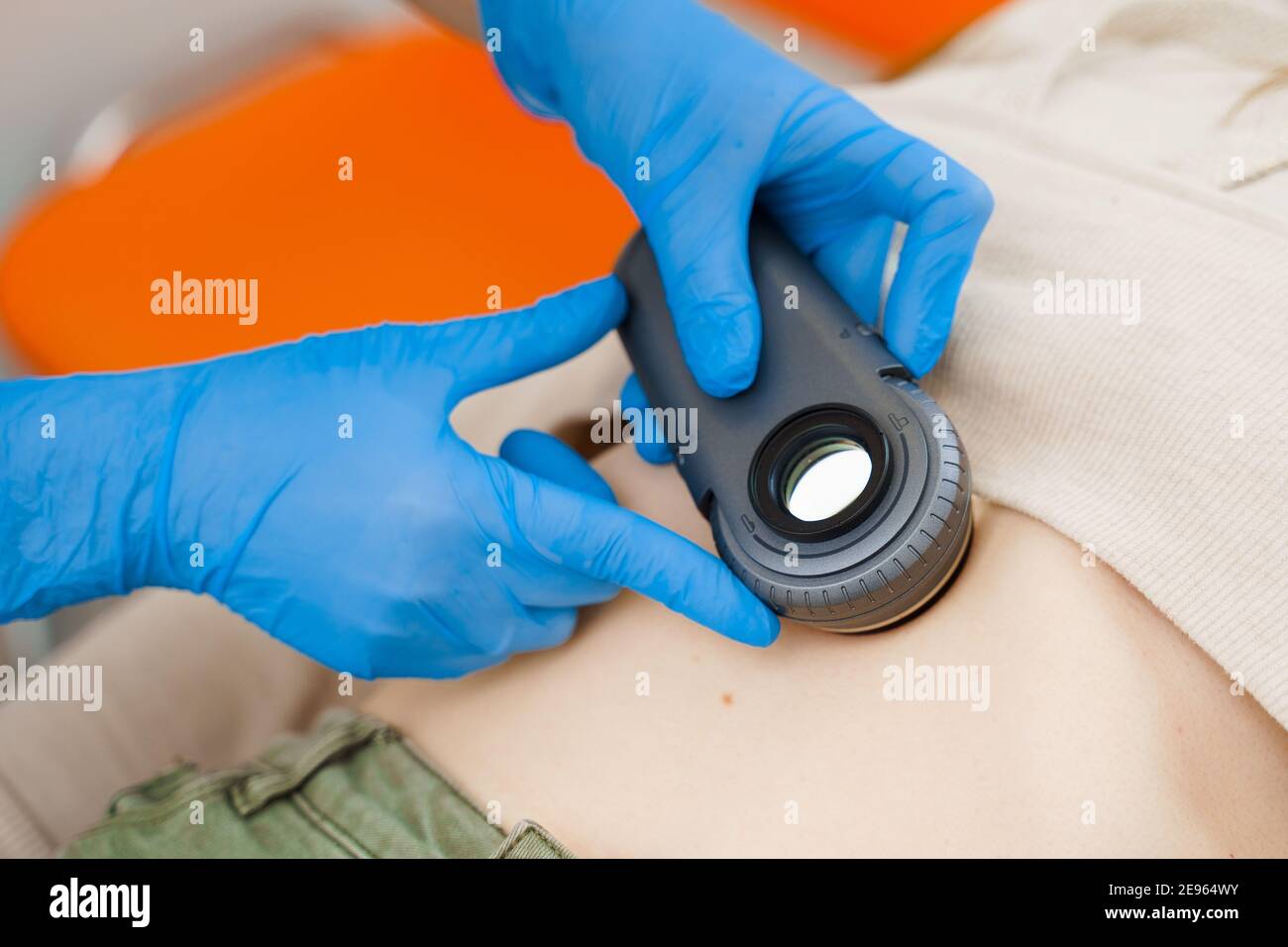 Dermatology Dermatoscope High Resolution Stock Photography and Images ...