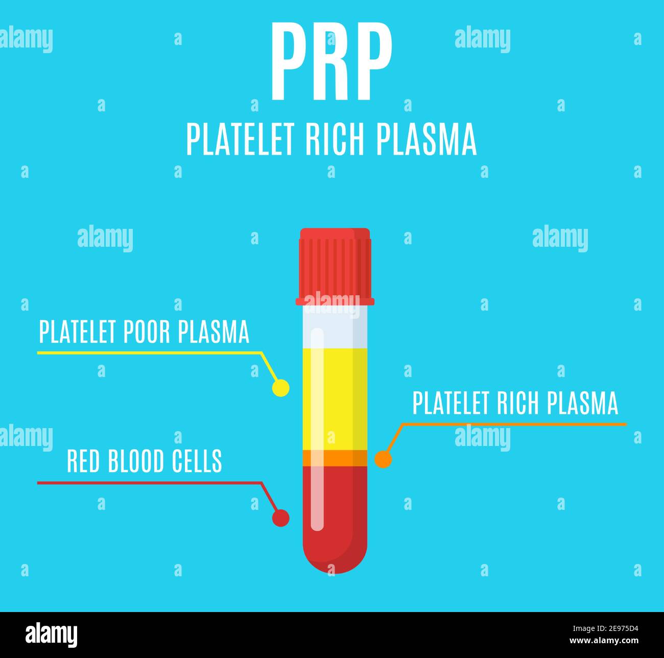 Blood filled syringe Stock Vector Images - Alamy
