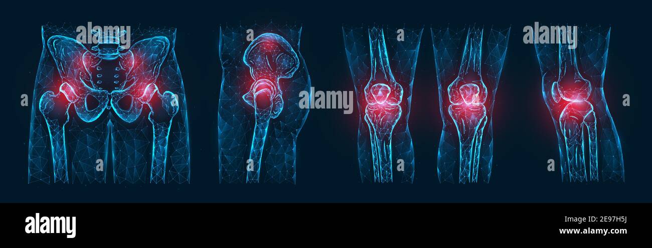 Polygonal vector illustration of pain or inflammation of the bones in ...