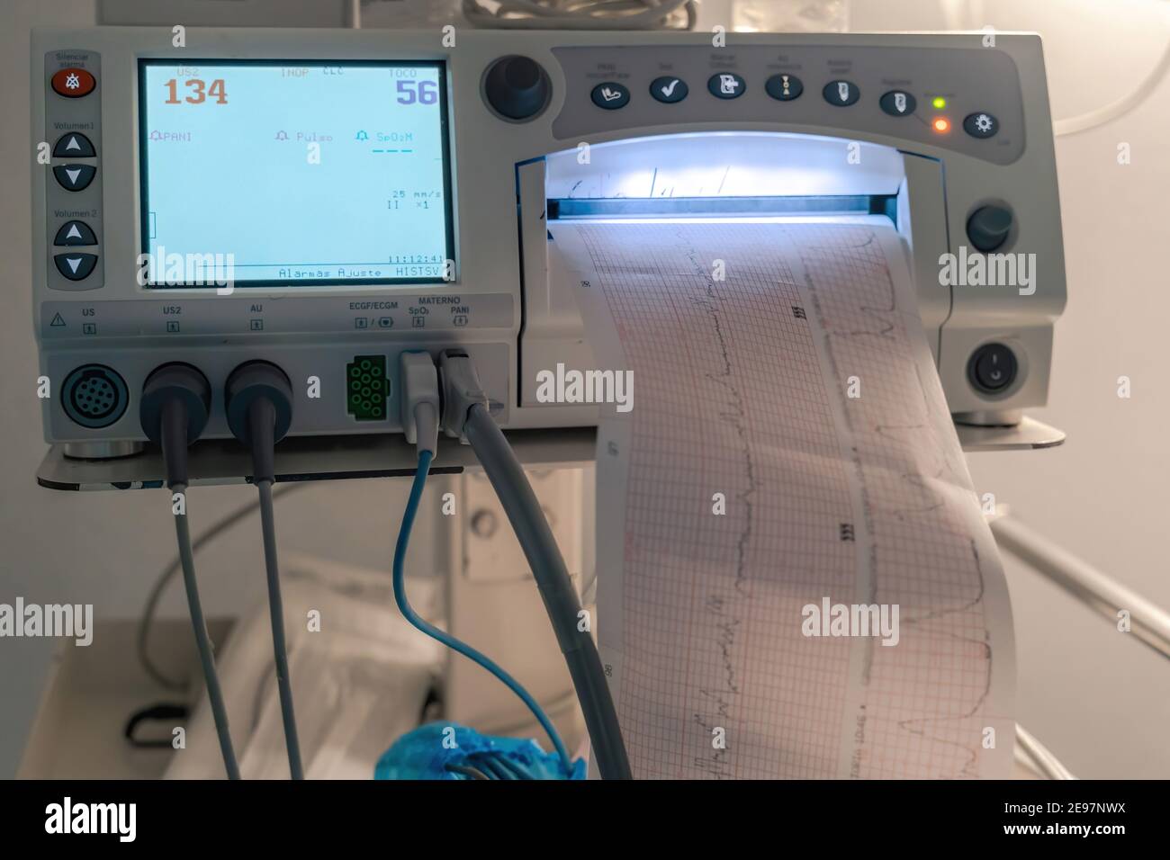 Maternal/fetal monitoring system. Full antepartum/intrapartum fetal ...