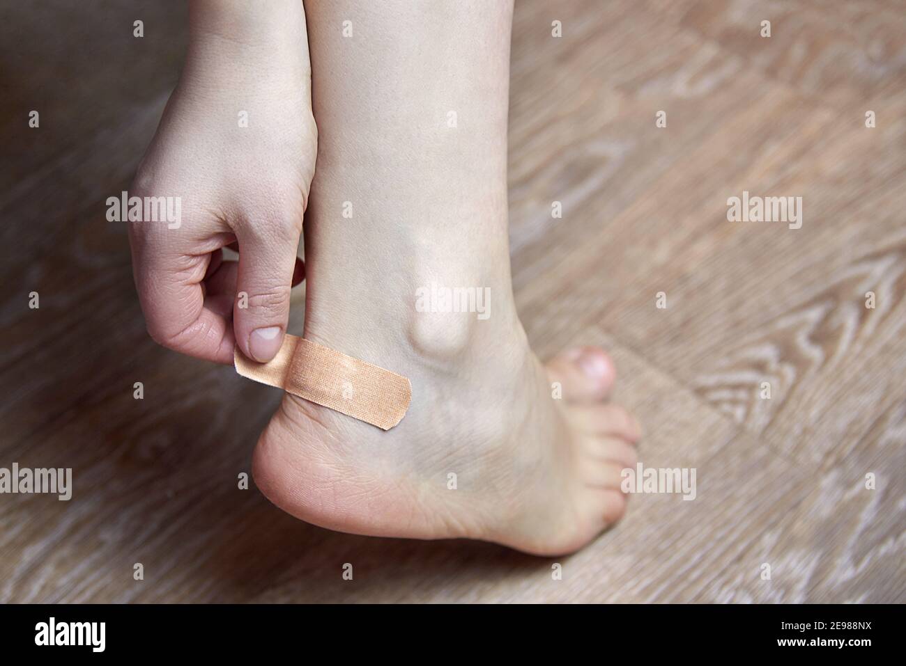 A woman glues a tissue plaster to a corn on her leg Stock Photo - Alamy