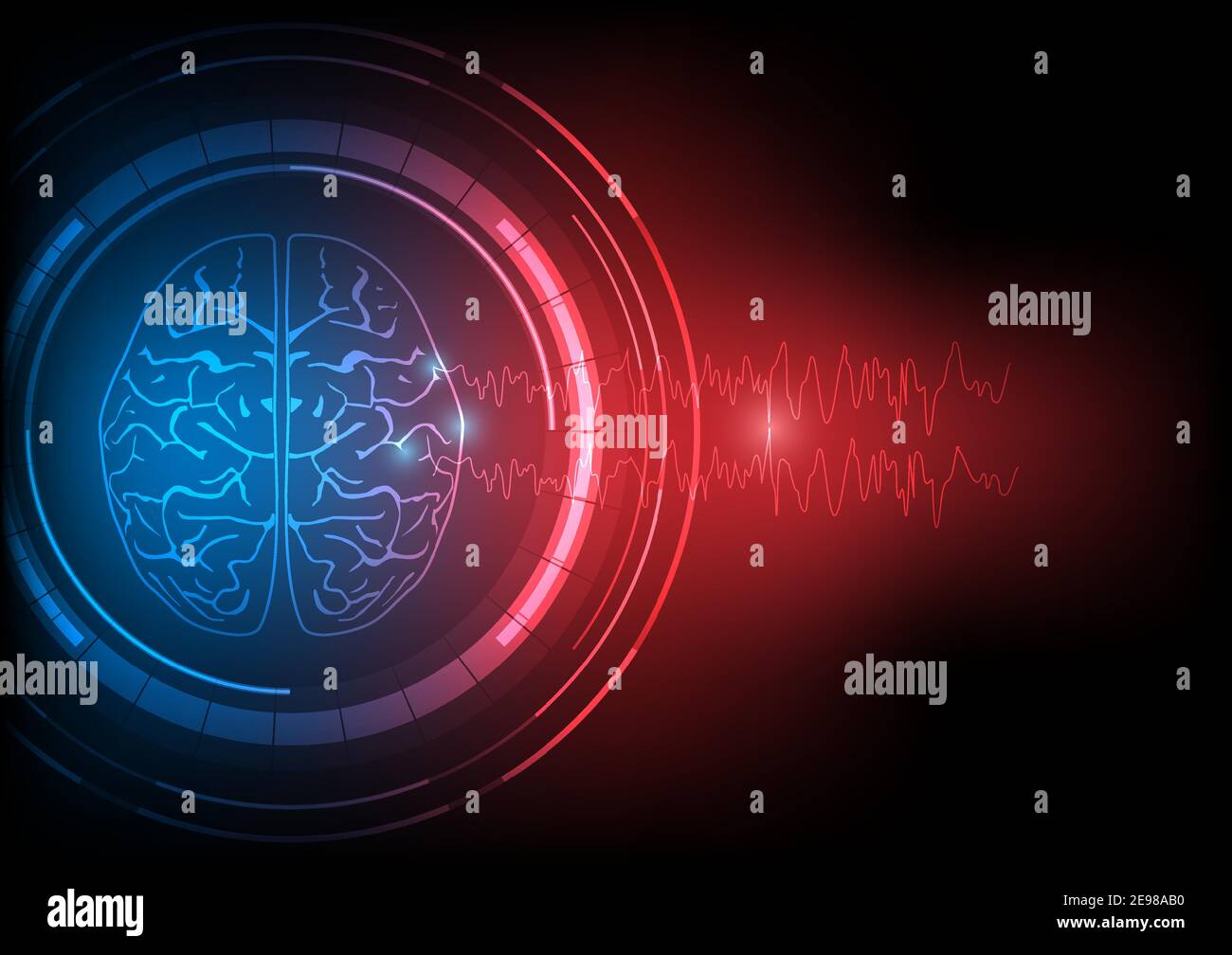 Epileptic brain hi-res stock photography and images - Alamy