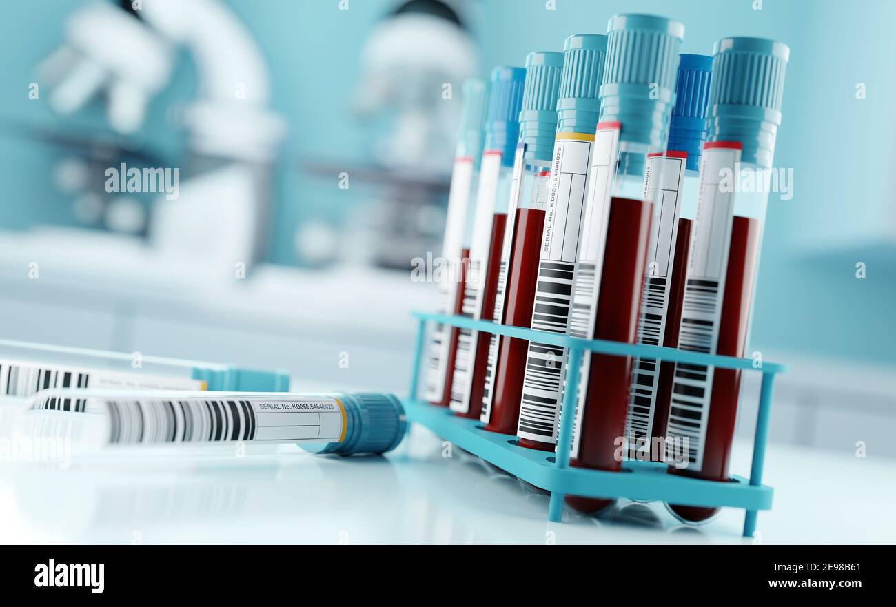 Bllod test hi-res stock photography and images - Alamy