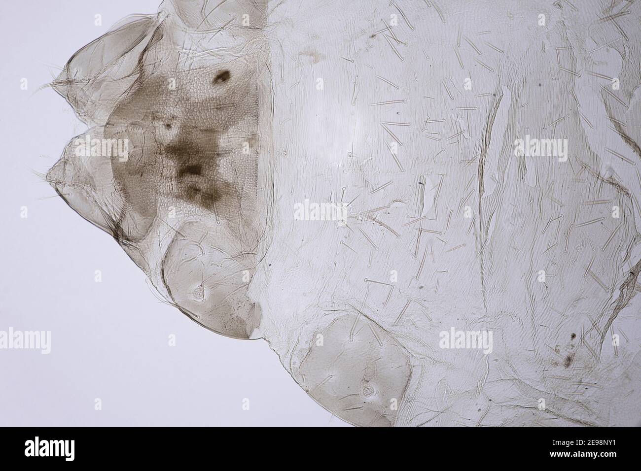 tail end of a human louse at 10 times magnification under a microscope ...