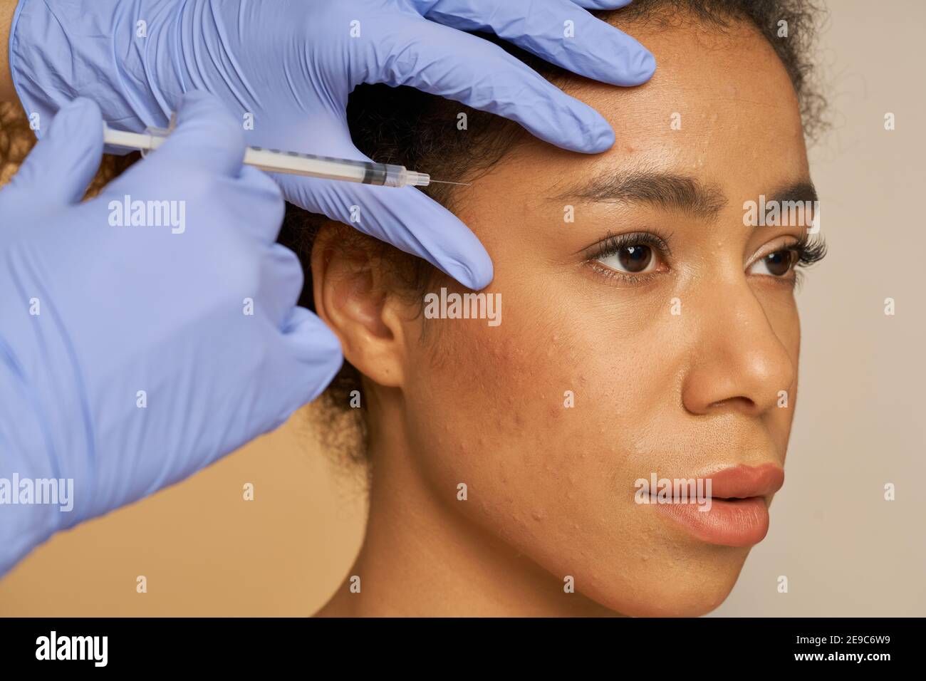 Portrait of beautiful young woman looking away while getting face ...