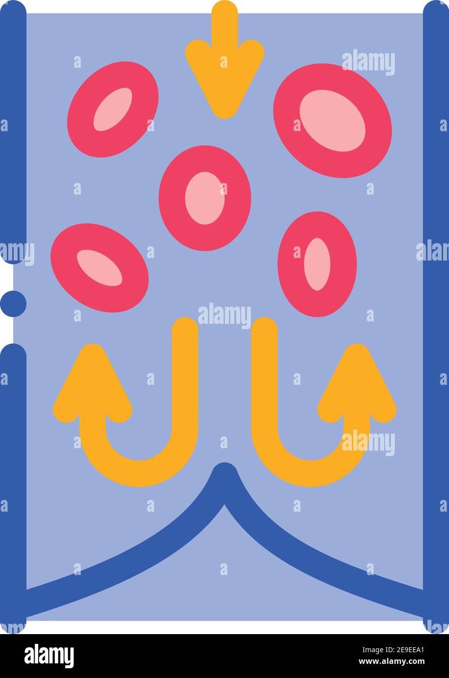 Vessel blockage Stock Vector Images - Alamy