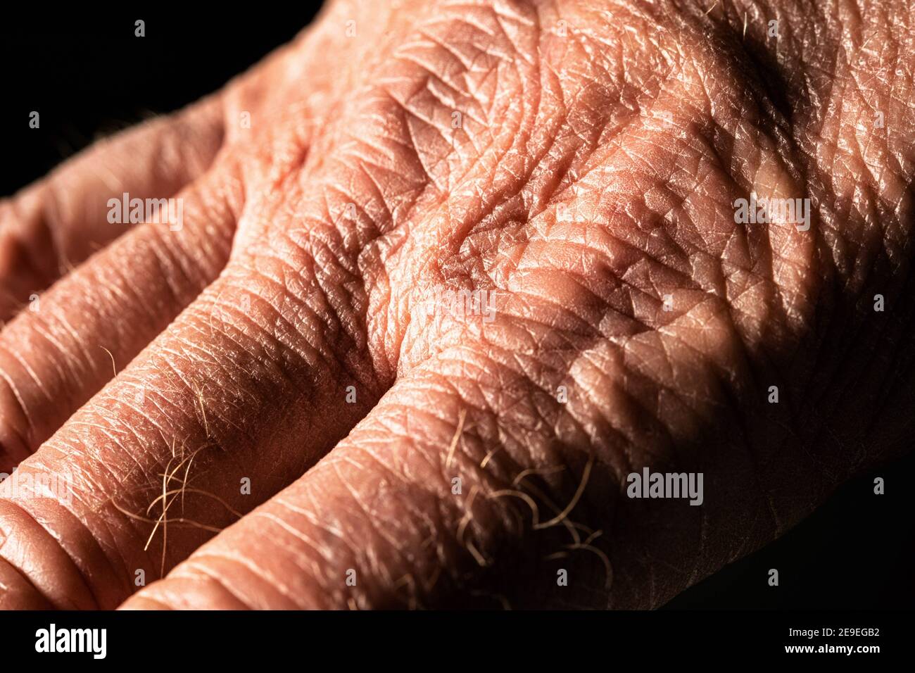 Weathered skin hi-res stock photography and images - Alamy