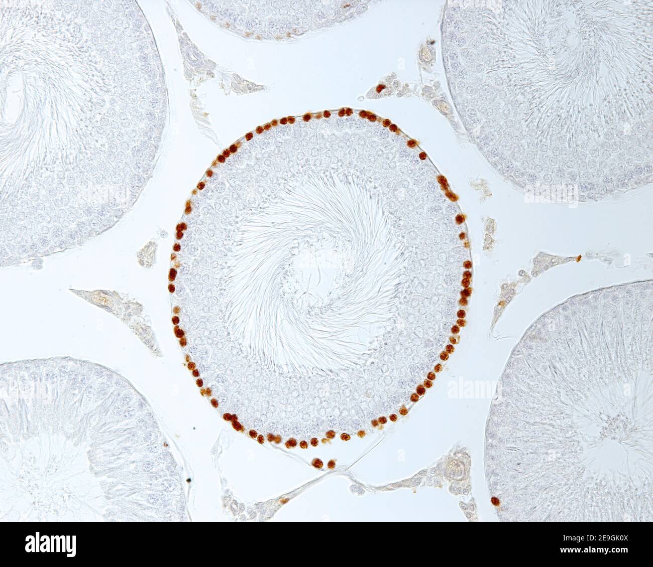 Labelling with bromodeoxiuridine (BrdU) of proliferating cells. The ...