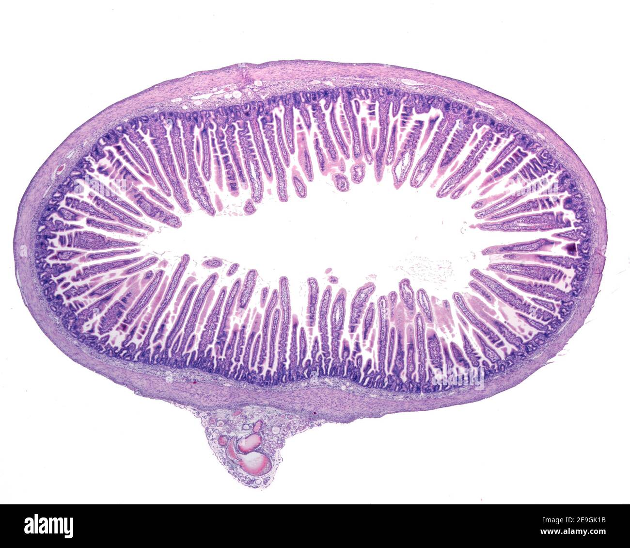Cross section of small intestine hi-res stock photography and images ...