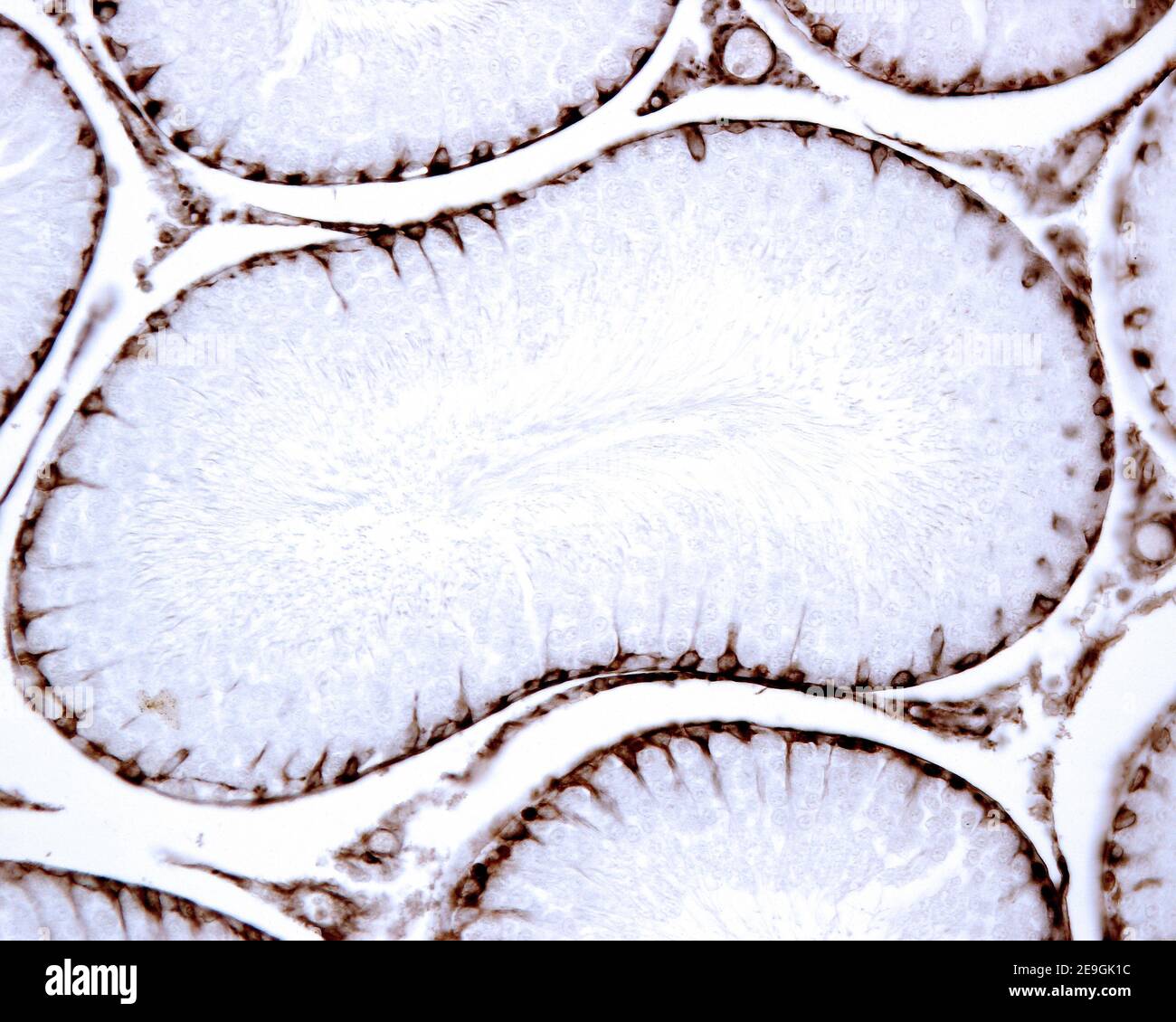Immunohistochemical stain for vimentin in a seminiferous tubule. The ...