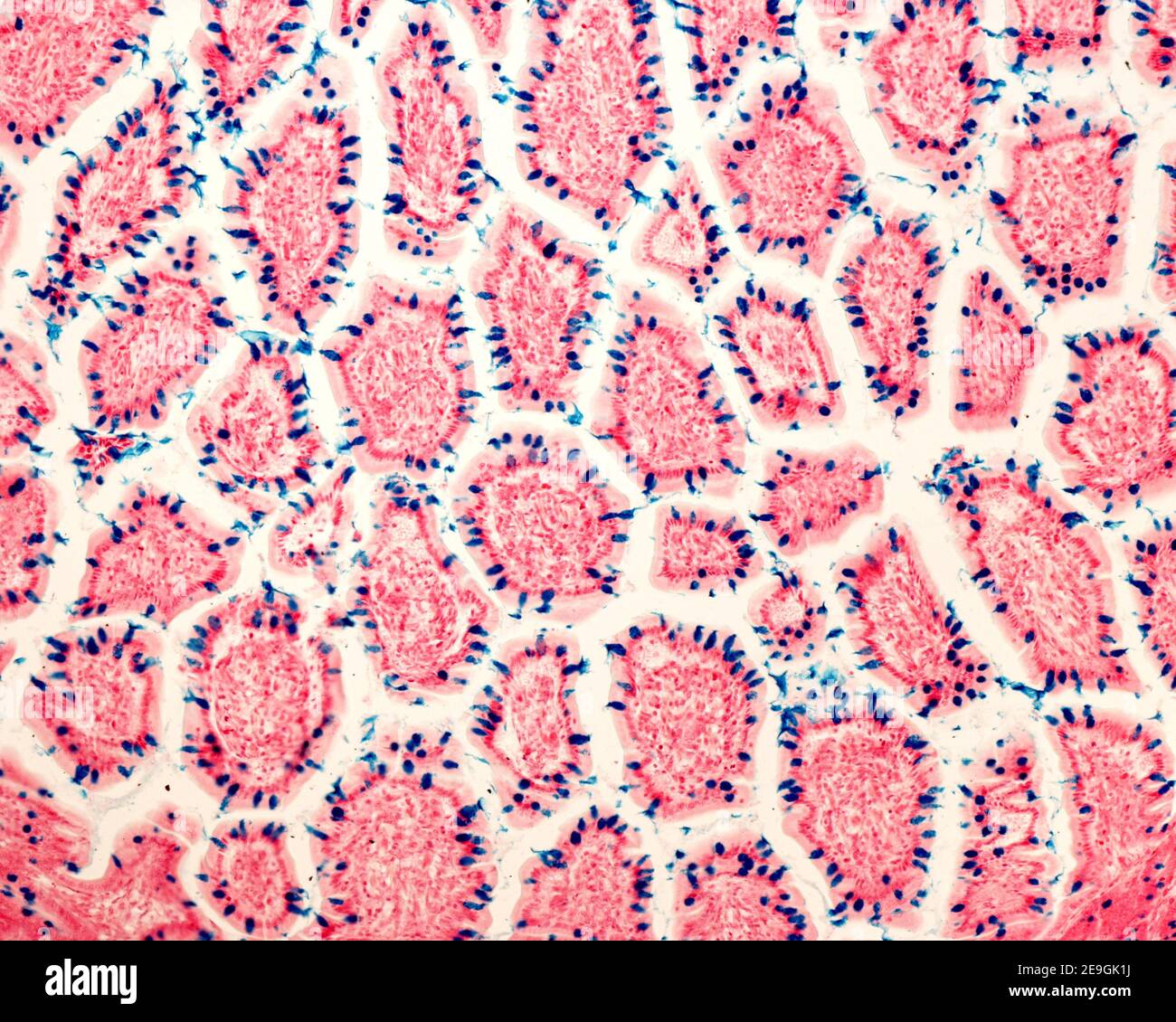 Cross sectioned small intestine villi stained with the Muller-Mowry ...