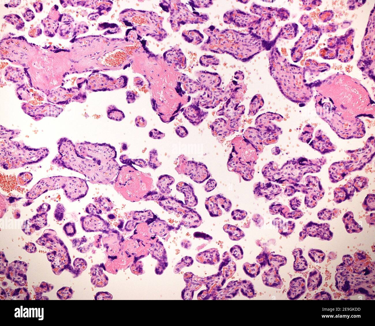 Chorionic Villi Histology
