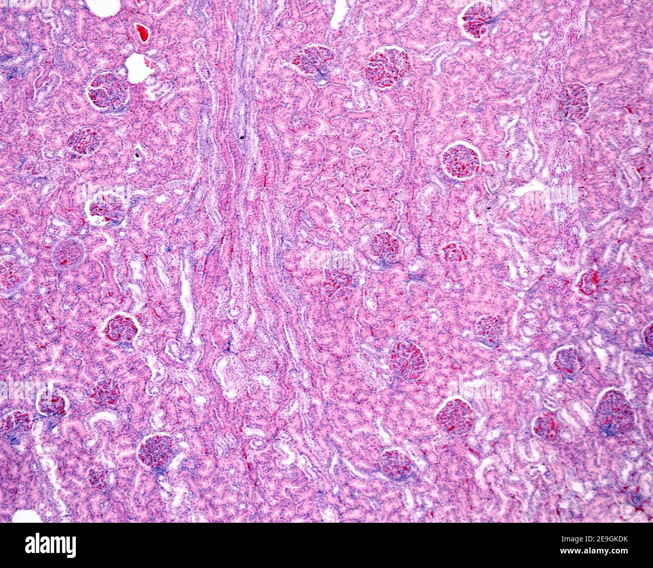 Glomerulus kidney hi-res stock photography and images - Alamy