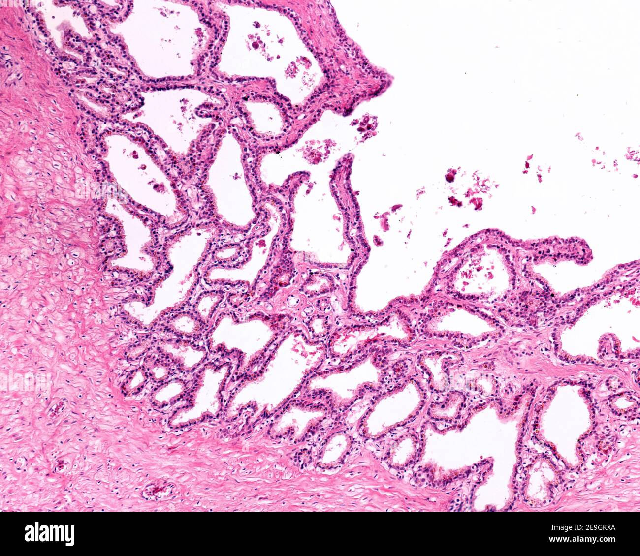 Wall of a human seminal vesicle. The mucosa show a very irregular ...