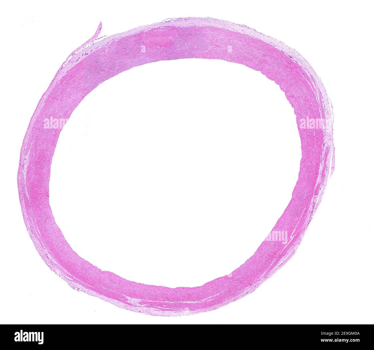 Very low magnification of a cross section of a human aorta. Almost the ...