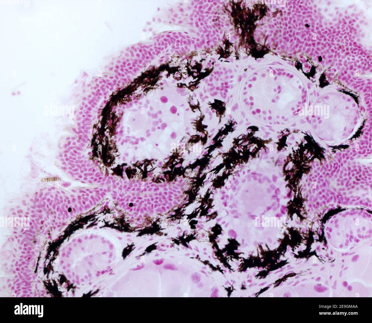 Chromatophore cells hi-res stock photography and images - Alamy