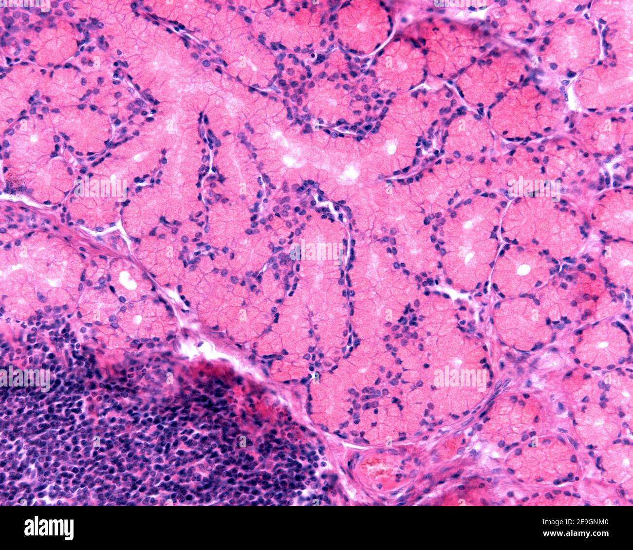 Brunner glands of the duodenum. In this section of that mucous ...